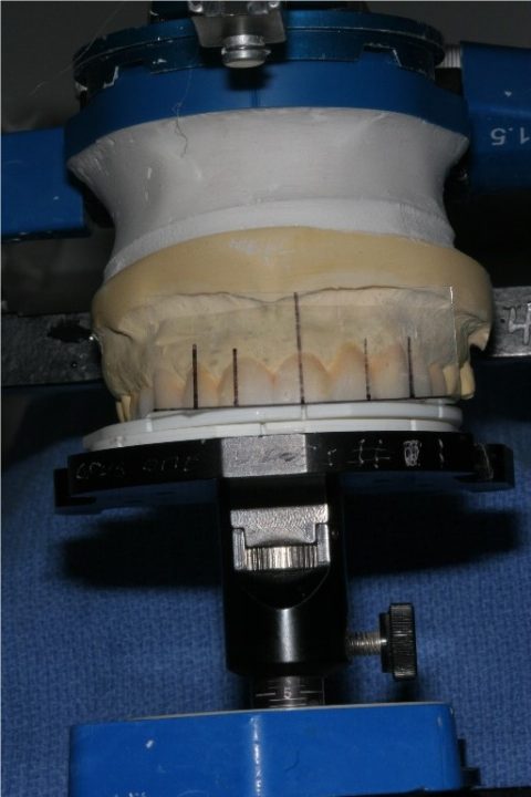 The Importance of Utilizing The Kois Facial Analyzer | OpusOneLabs